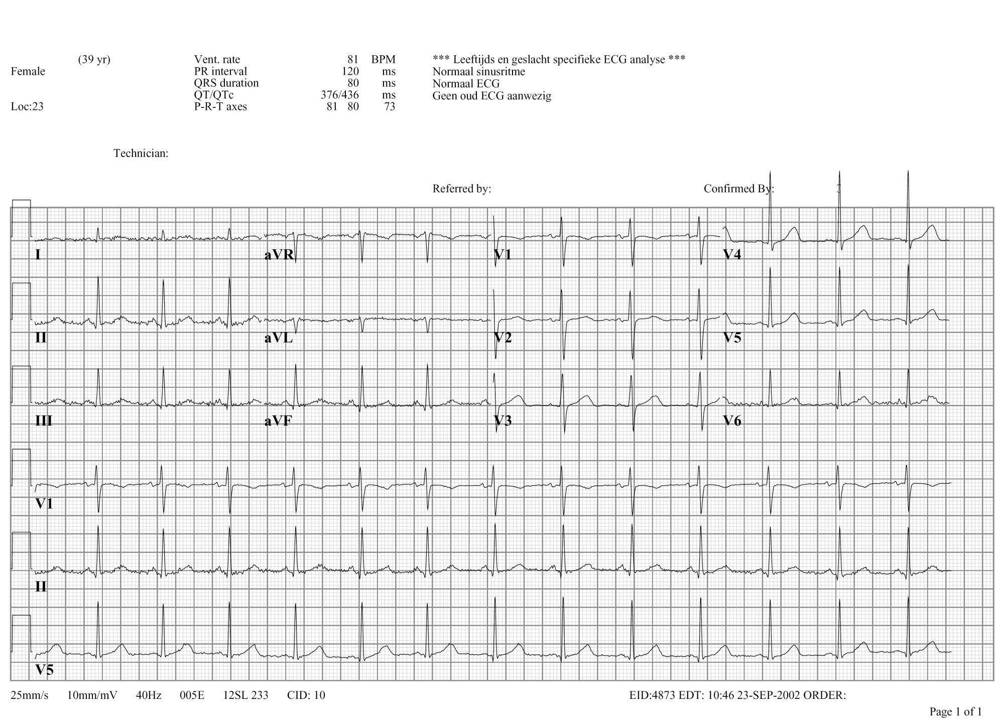 Bestand:Normaal ecg.jpg - ECGpedia